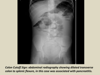 Presentation1, interpretation of x ray of the abdomen. | PPTX