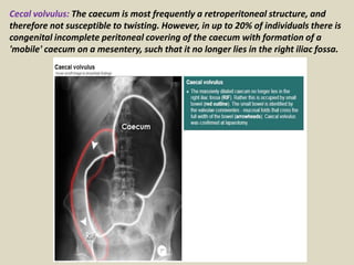 Presentation1, interpretation of x ray of the abdomen. | PPTX