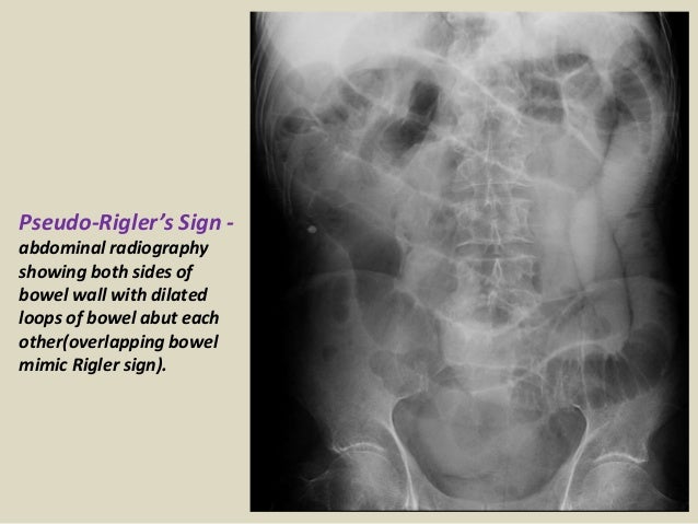 Presentation1, interpretation of x ray of the abdomen.