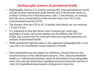periodontal health..WORLD WORKSHOP 2017 | PPT