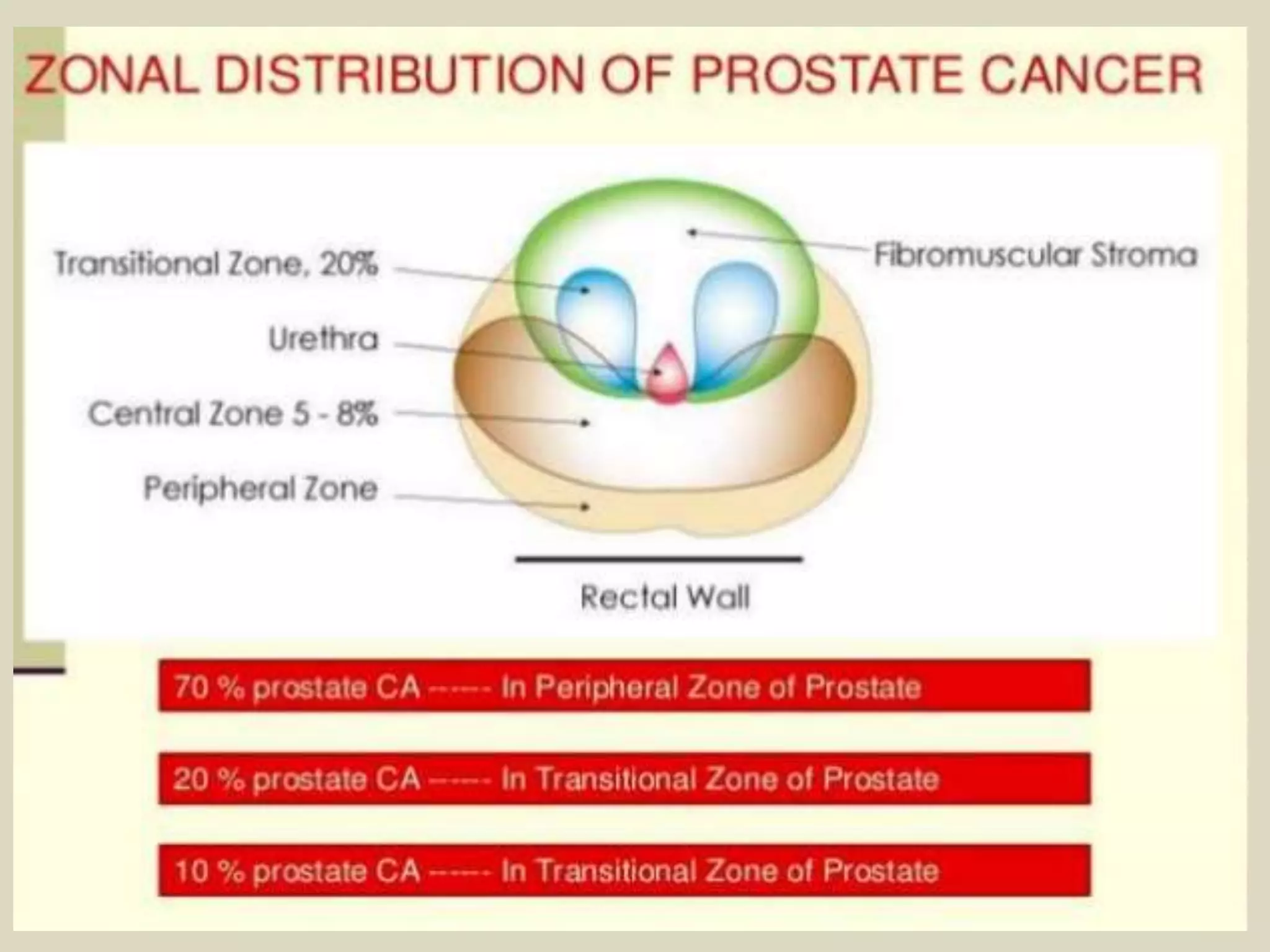 Presentation1, mri imaging of the prostate | PPTX