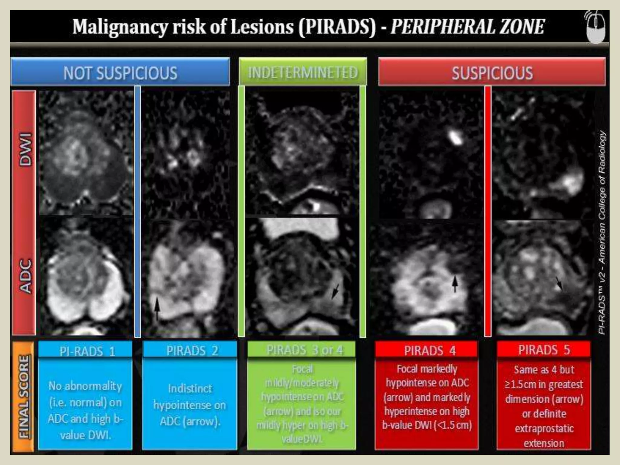 Presentation1, mri imaging of the prostate | PPTX