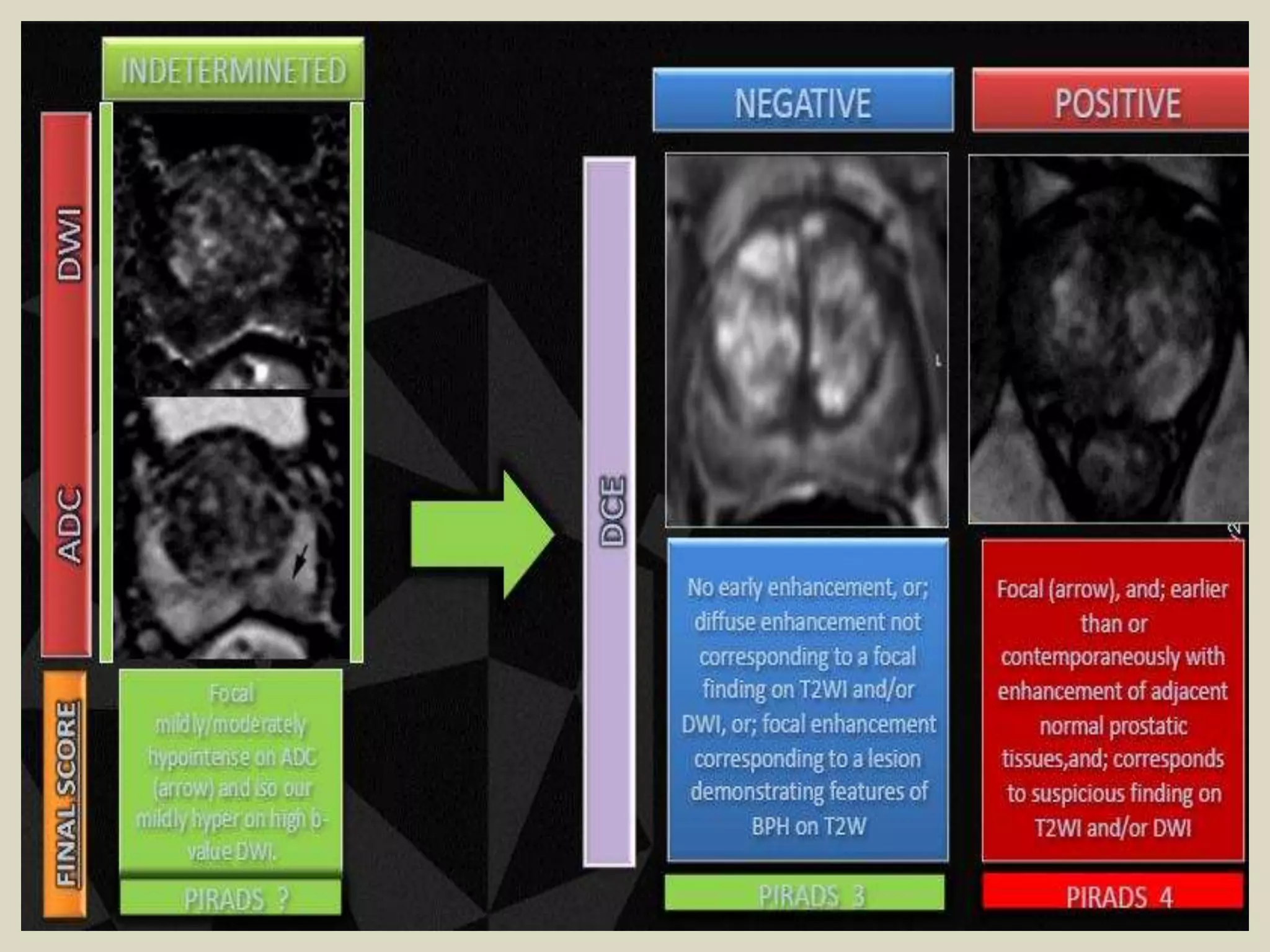 Presentation1, mri imaging of the prostate | PPTX