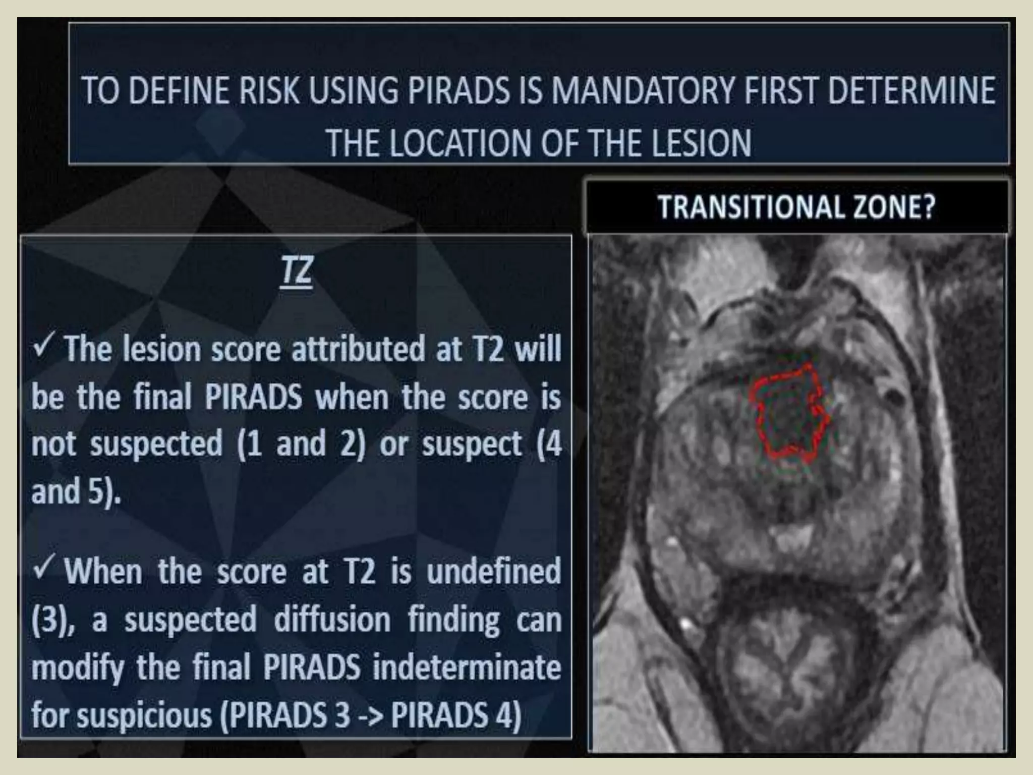 Presentation1, mri imaging of the prostate | PPTX
