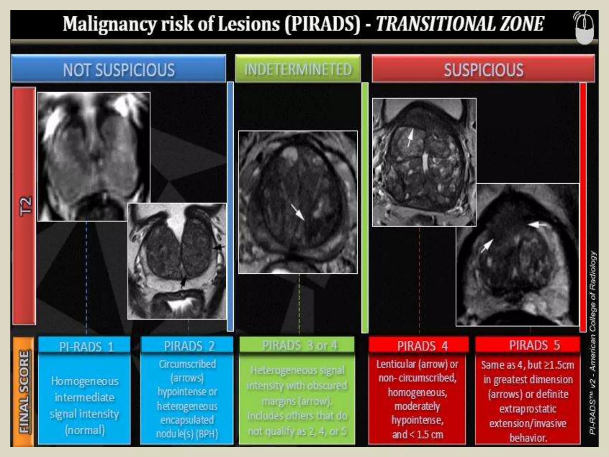 Presentation1, mri imaging of the prostate | PPTX