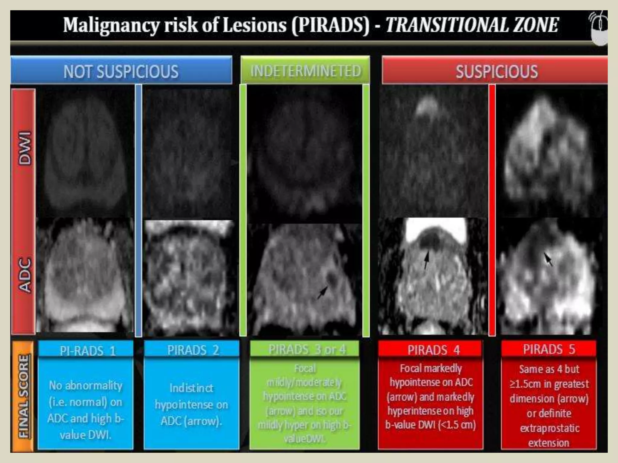 Presentation1, mri imaging of the prostate | PPTX