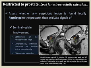 Presentation1, mri imaging of the prostate | PPTX
