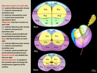 Presentation1, mri imaging of the prostate | PPT