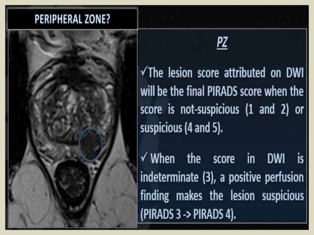 Presentation1, mri imaging of the prostate | PPT