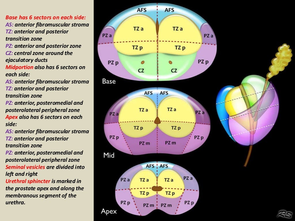 Presentation1 Mri Imaging Of The Prostate