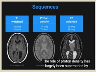 Presentation1, mr pulse sequences. | PPTX