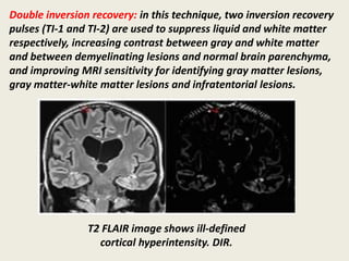 Presentation1, new mri techniques in the diagnosis and monitoring of ...