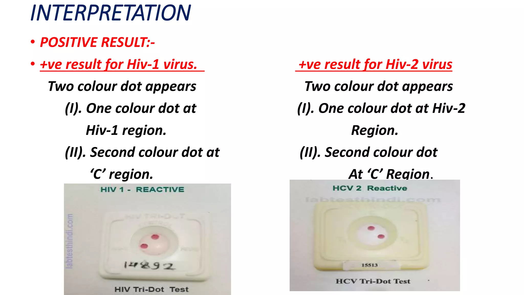 HIV TRI DOT TEST//Microbiology | PPTX