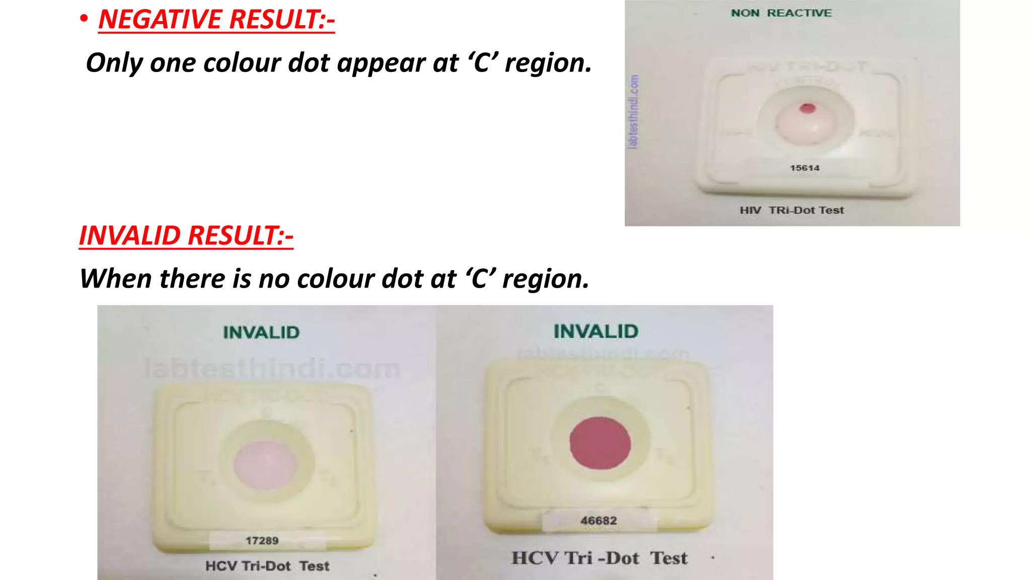 HIV TRI DOT TEST//Microbiology | PPTX
