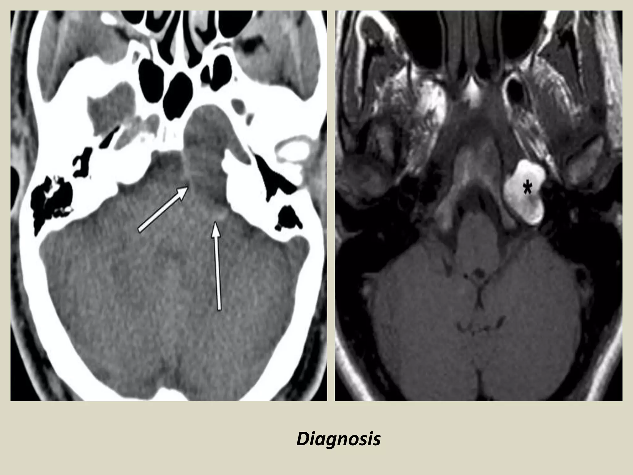 Presentation1, quiz for the petrous bone and para nasal sinuses. | PPTX