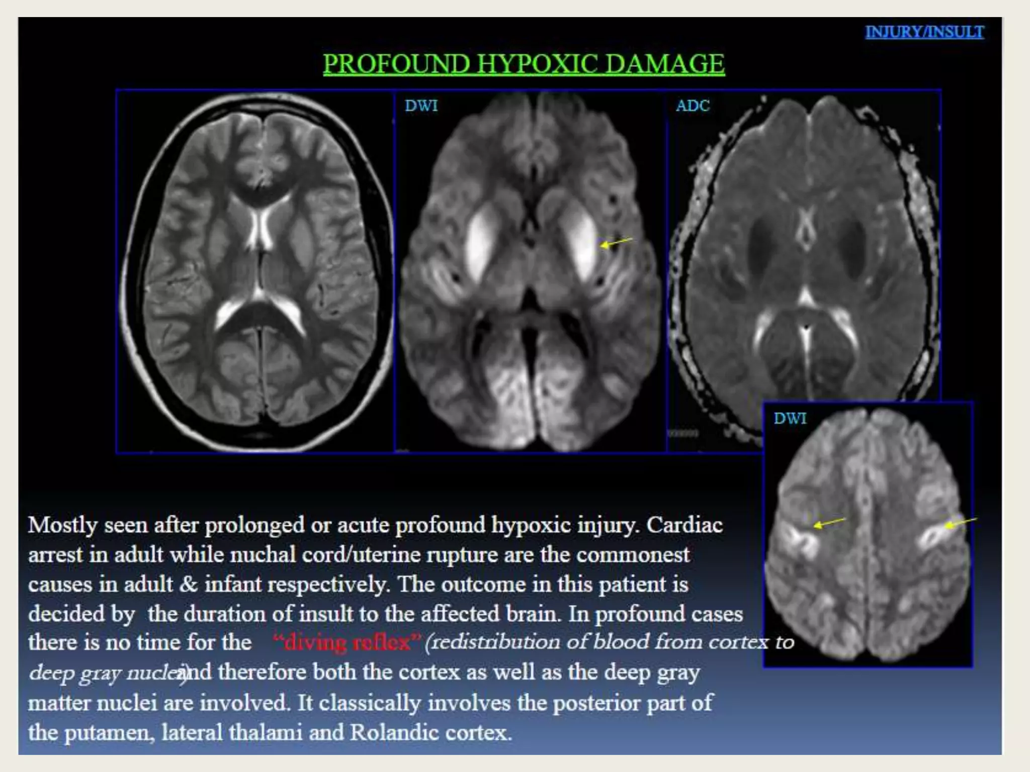 Presentation1, radiological application of diffusion weighted imges in ...
