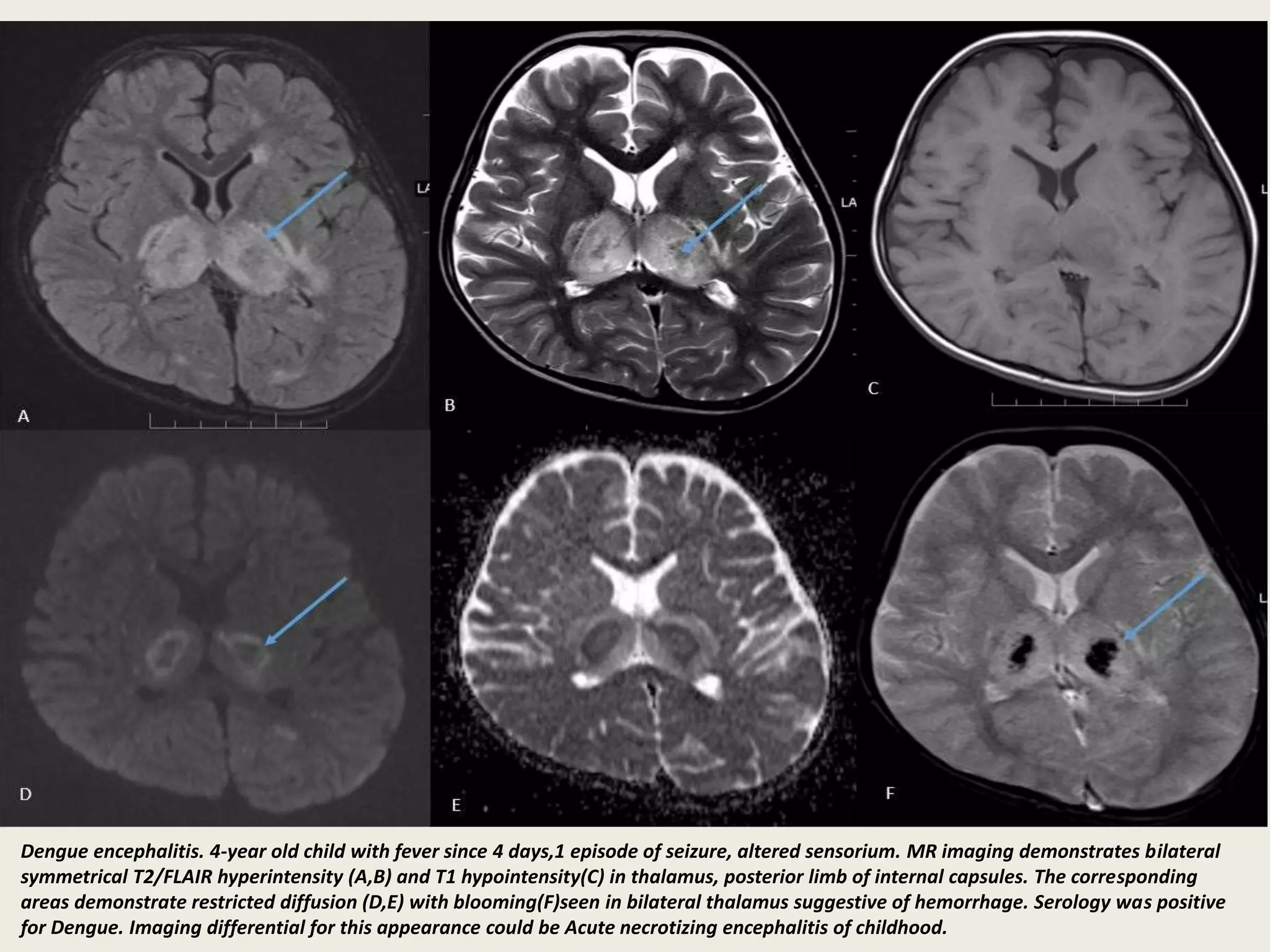 Presentation1, radiological application of diffusion weighted imges in ...