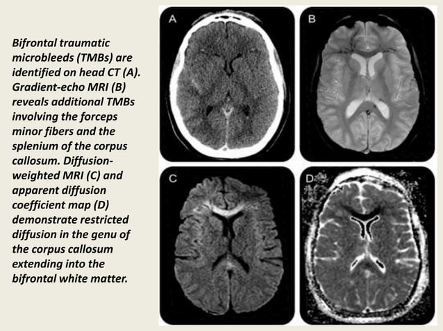 Presentation1, radiological application of diffusion weighted imges in ...