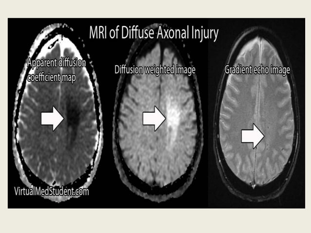 Presentation1, radiological application of diffusion weighted imges in ...