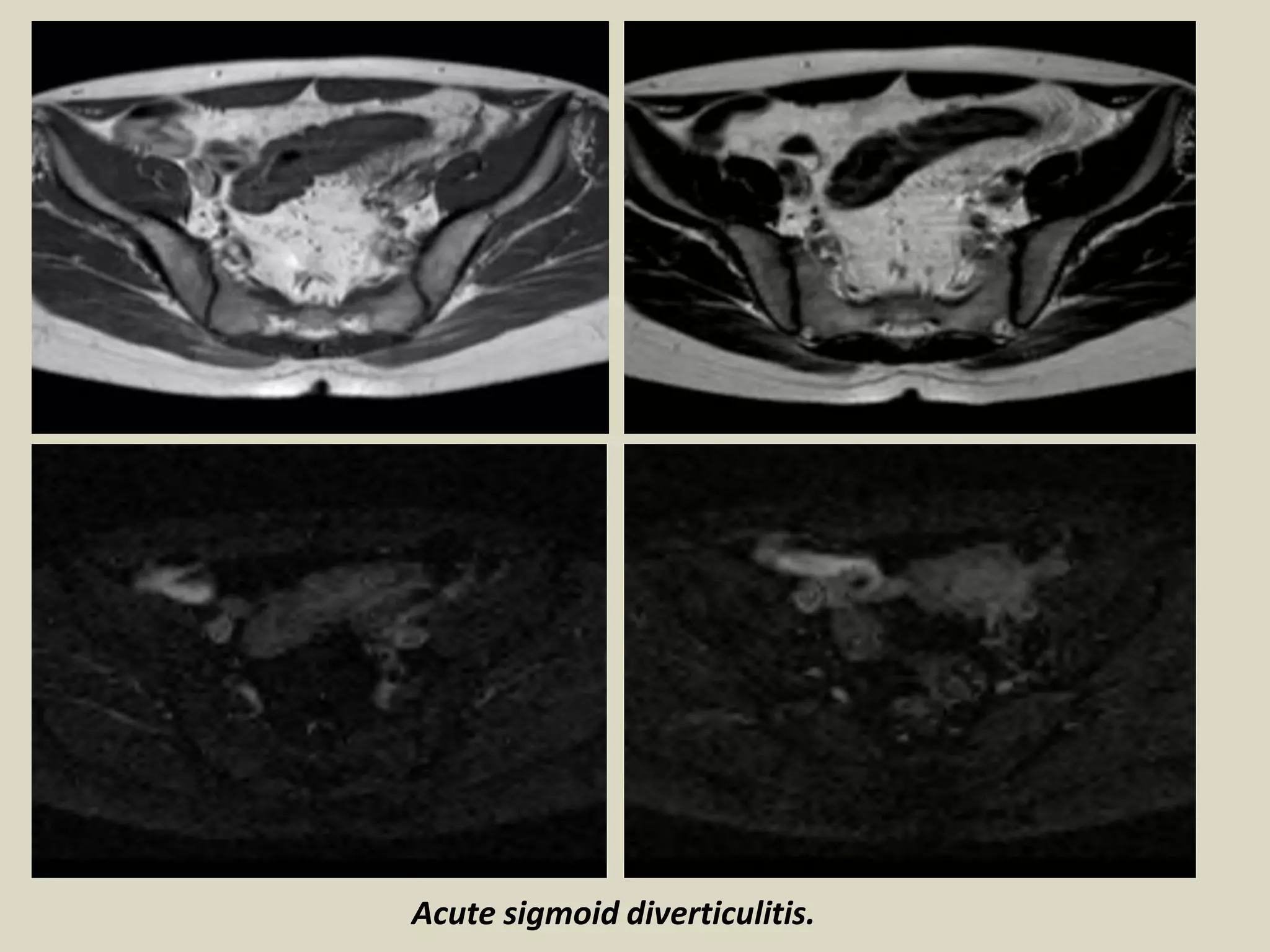Presentation1, radiological application of diffusion weighted images in ...