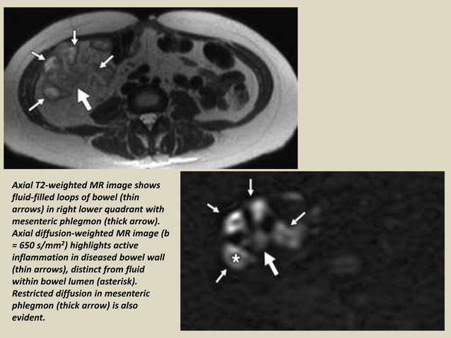 Presentation1, radiological application of diffusion weighted images in ...