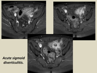 Presentation1, radiological application of diffusion weighted images in ...