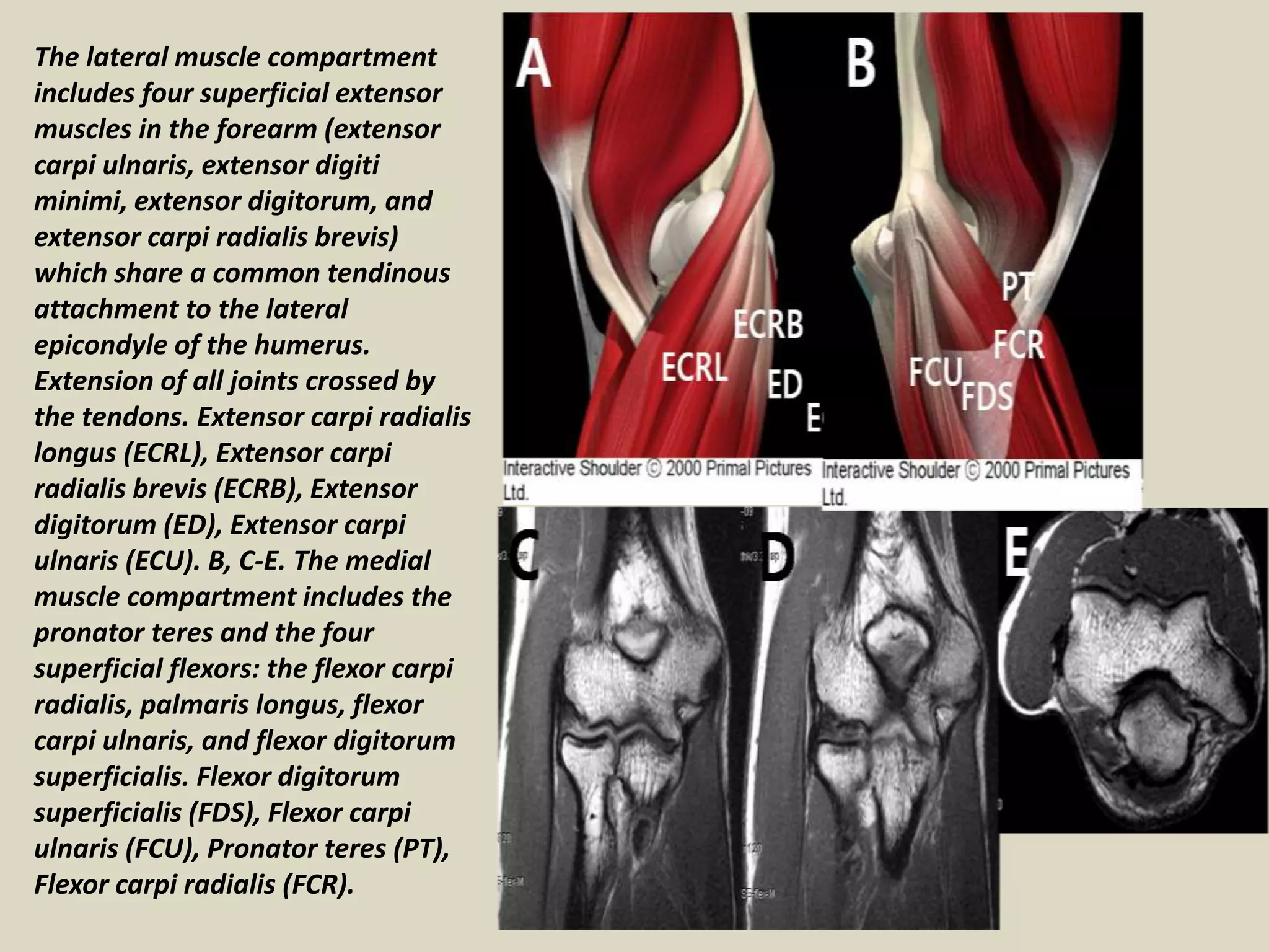 Presentation1, radiological film reading of elbow joint. | PPTX