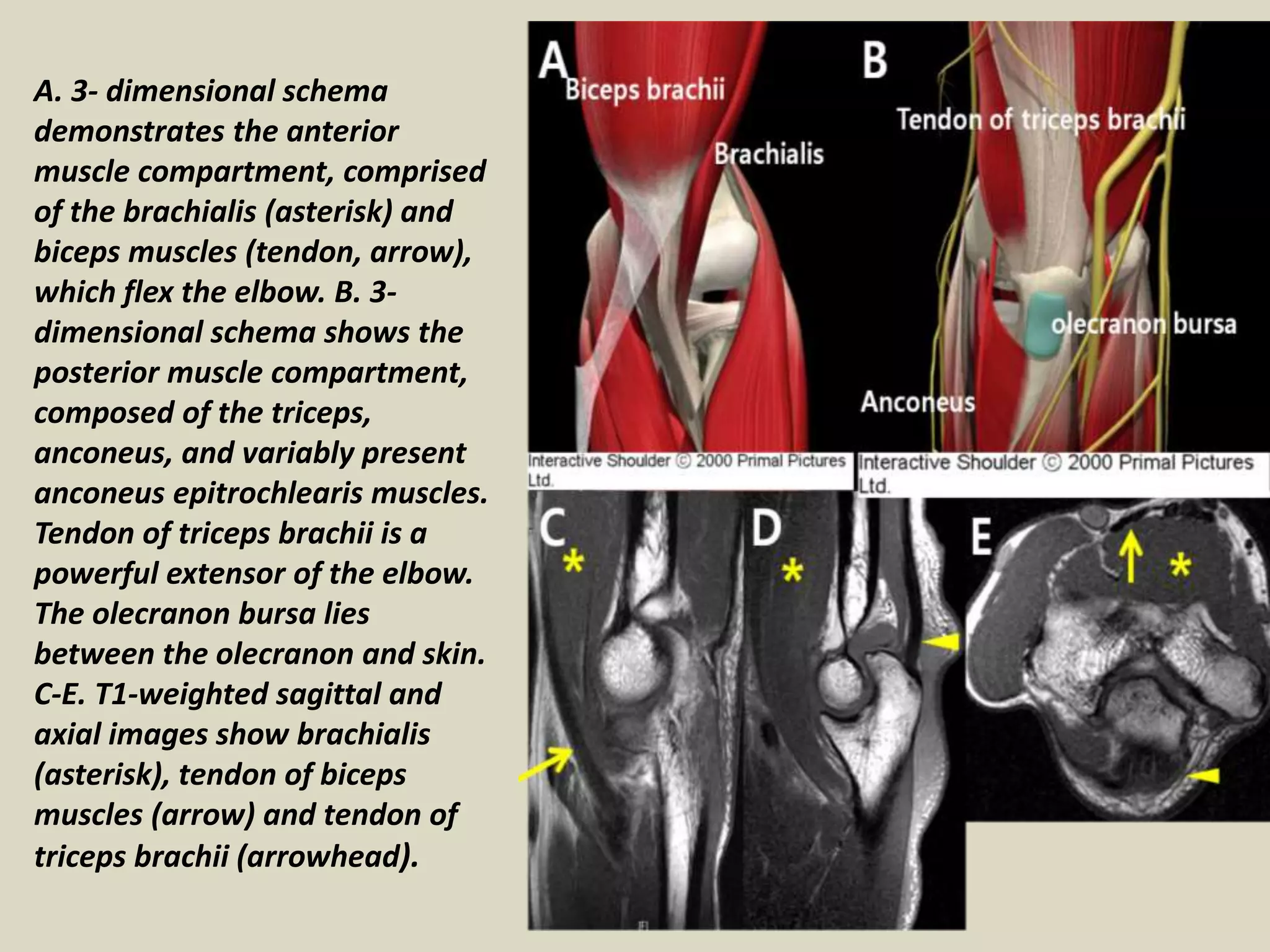 Presentation1, radiological film reading of elbow joint. | PPTX
