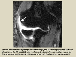 Presentation1, radiological film reading of elbow joint. | PPTX