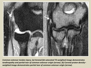 Presentation1, radiological film reading of elbow joint. | PPTX