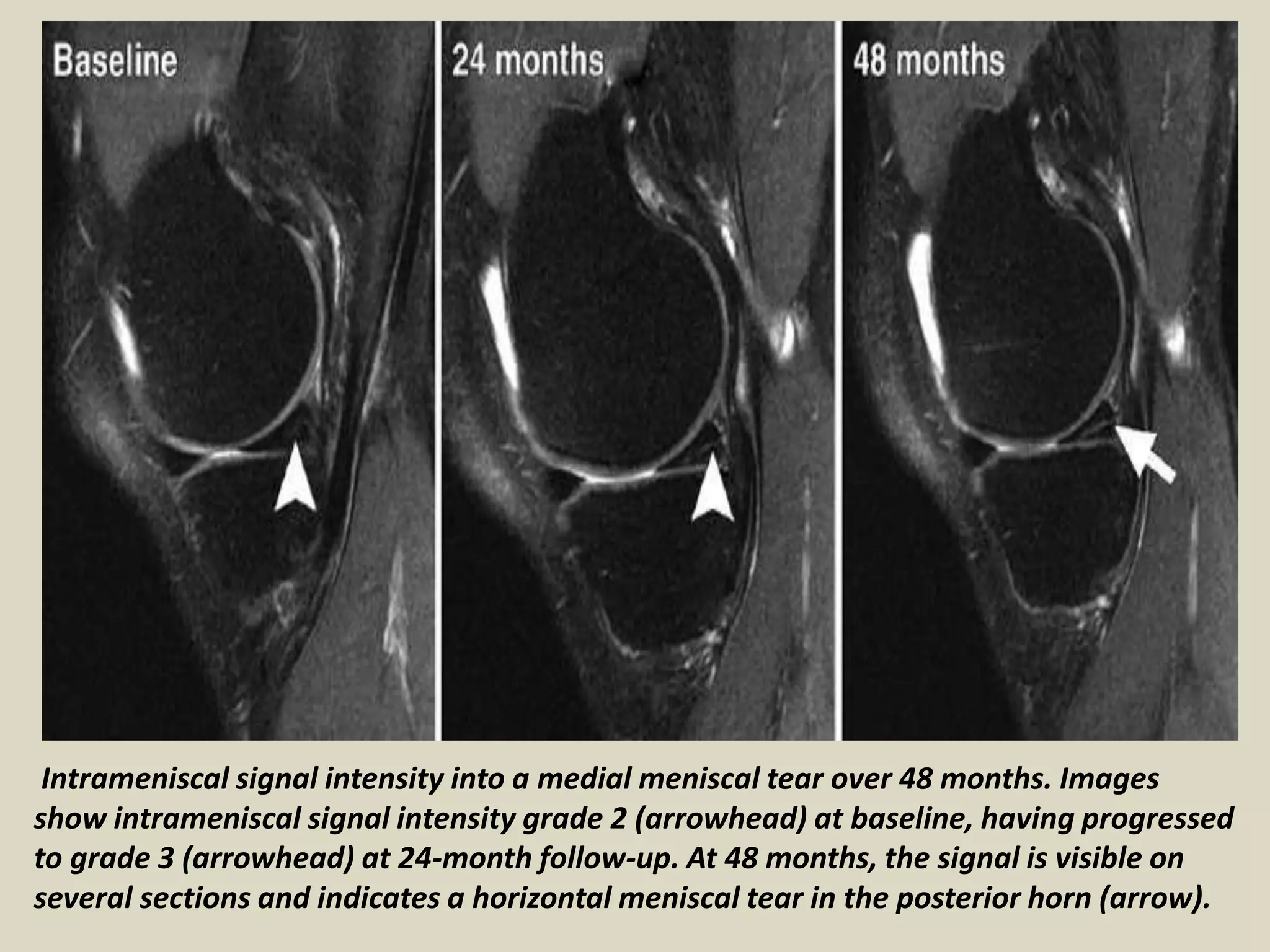 Presentation1, radiological film reading of knee joint. | PPTX