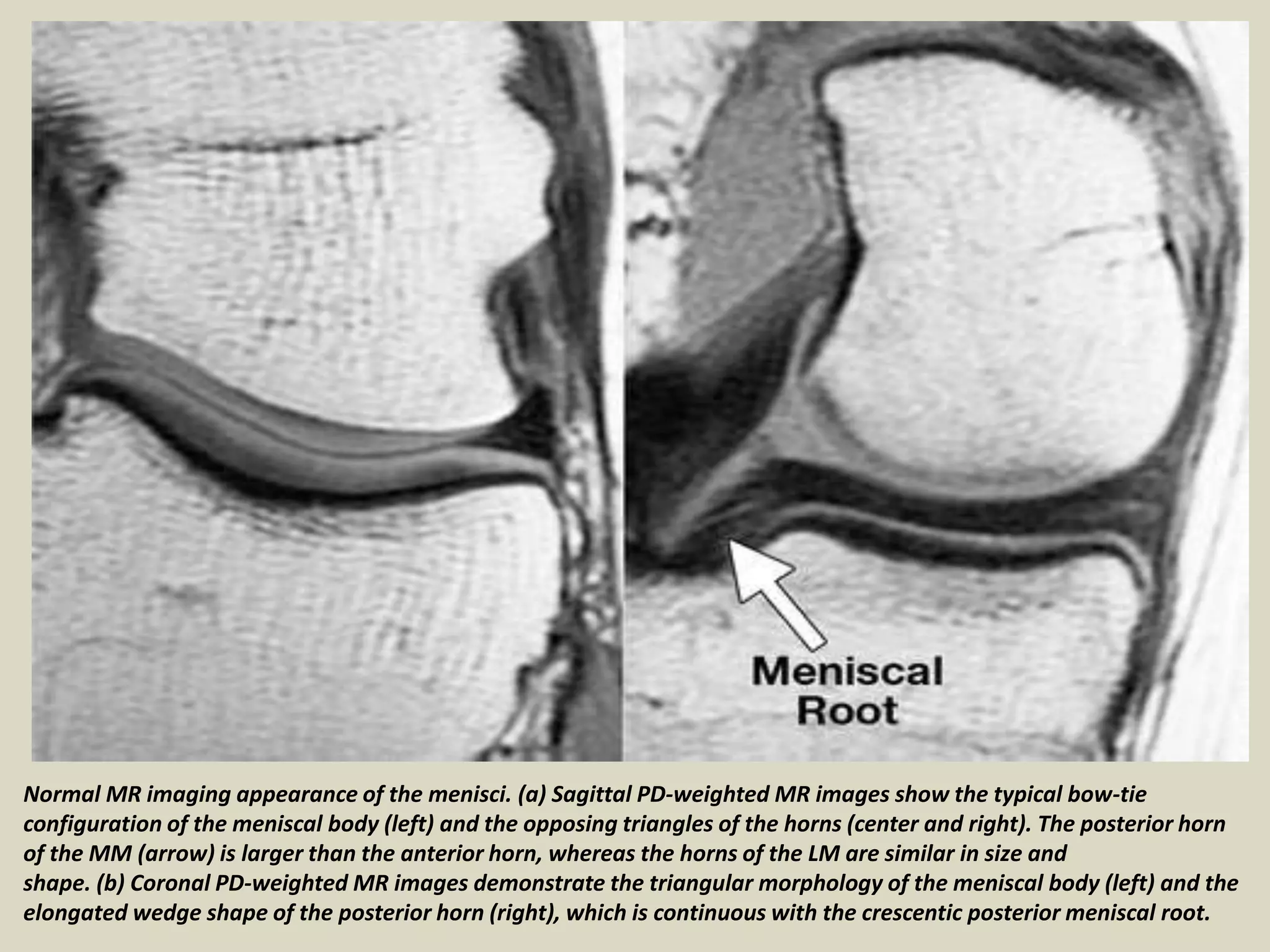 Presentation1, radiological film reading of knee joint. | PPTX