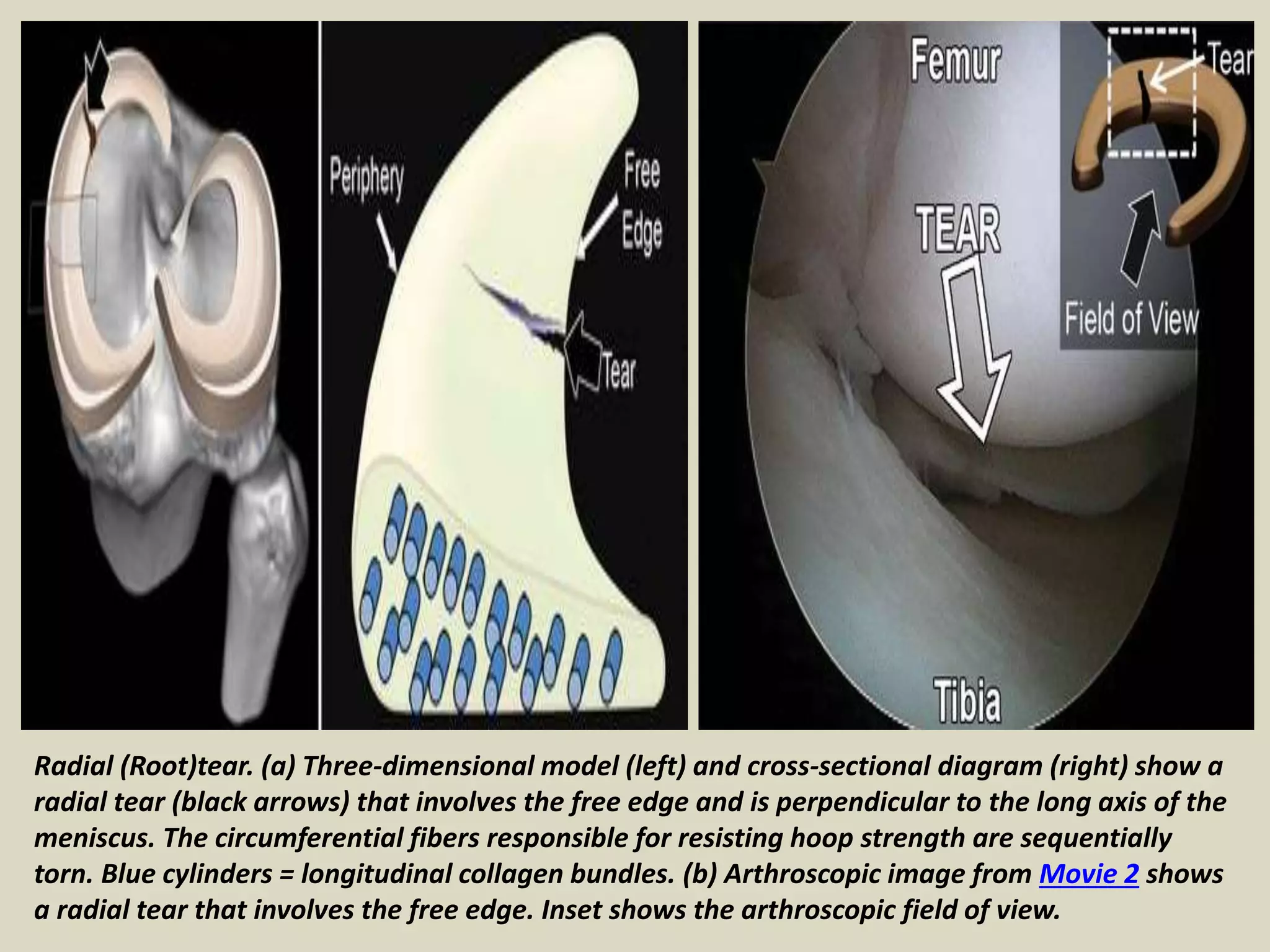 Presentation1, radiological film reading of knee joint. | PPTX