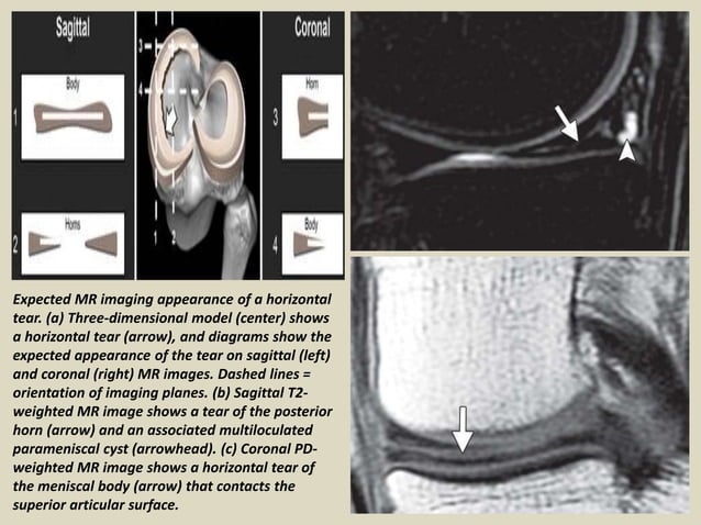 Presentation1, radiological film reading of knee joint. | PPT