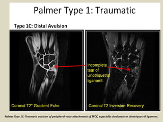 Presentation1 radiological film reading of wrist joint. | PPTX