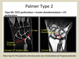 Presentation1 radiological film reading of wrist joint. | PPTX