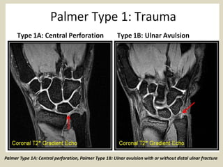 Presentation1 radiological film reading of wrist joint. | PPTX