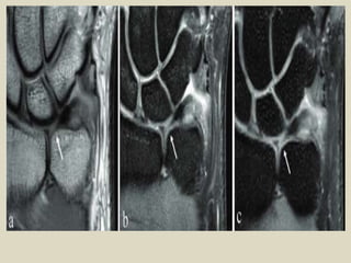 Presentation1 radiological film reading of wrist joint. | PPTX