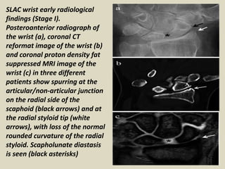 Presentation1 radiological film reading of wrist joint. | PPTX