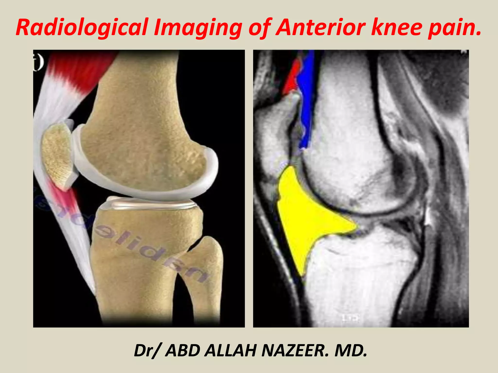 Anterior Knee Pain Pdf | YOUR GUIDE TO ANTERIOR KNEE PAIN – TSDG