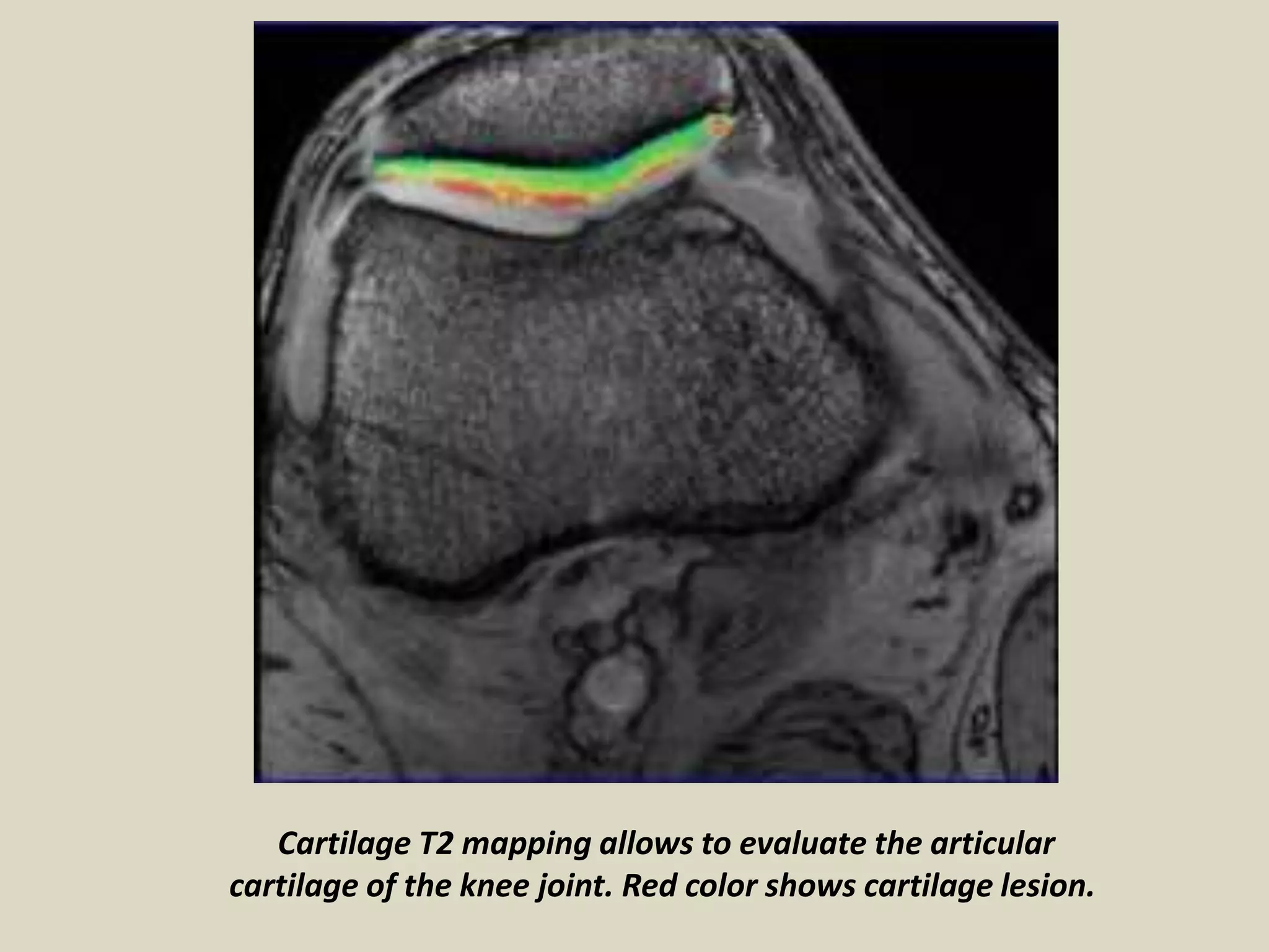 Presentation1, radiological imaging of anterior knee pain. | PPTX