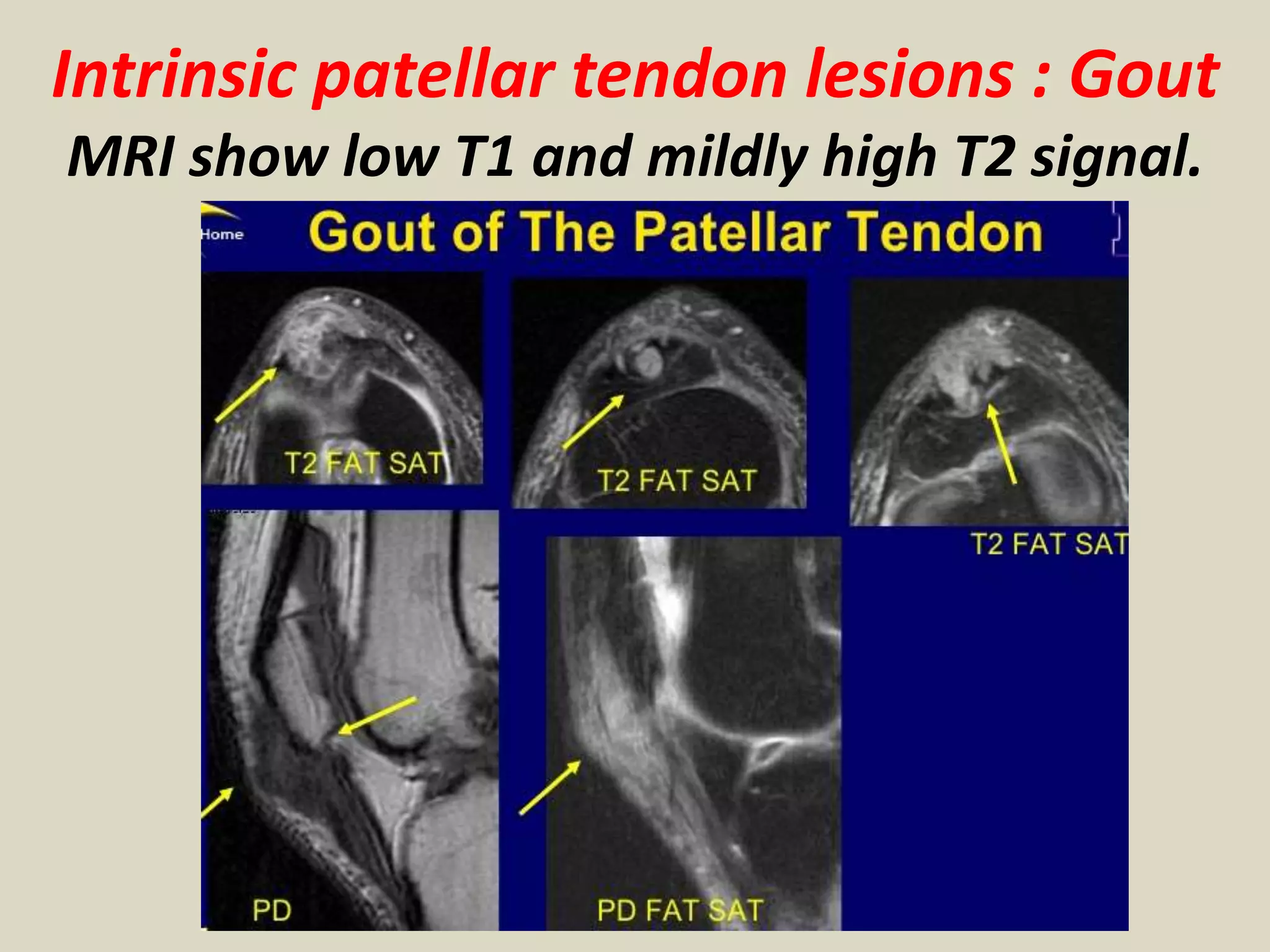 Presentation1, radiological imaging of anterior knee pain. | PPTX