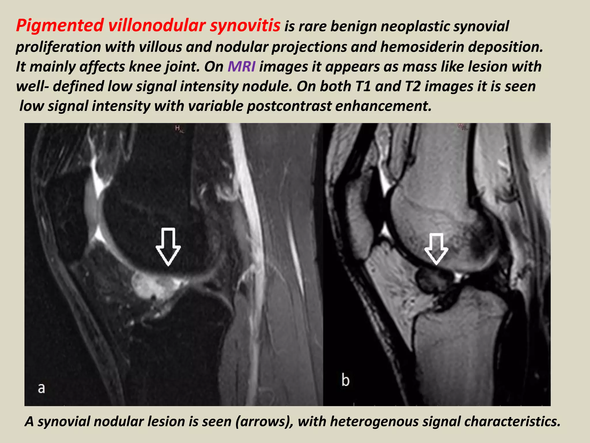 Presentation1, radiological imaging of anterior knee pain. | PPTX