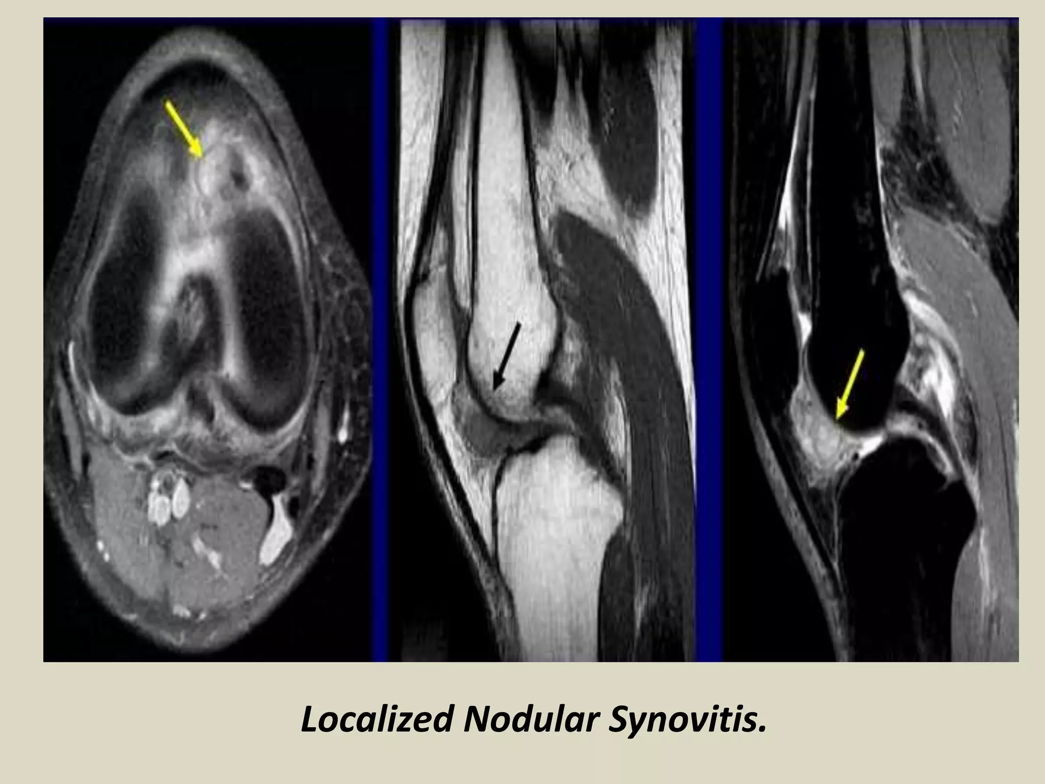 Presentation1, radiological imaging of anterior knee pain. | PPTX