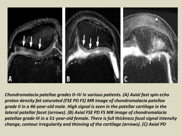 Presentation1, radiological imaging of anterior knee pain. | PPTX