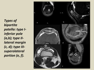 Presentation1, radiological imaging of anterior knee pain. | PPTX