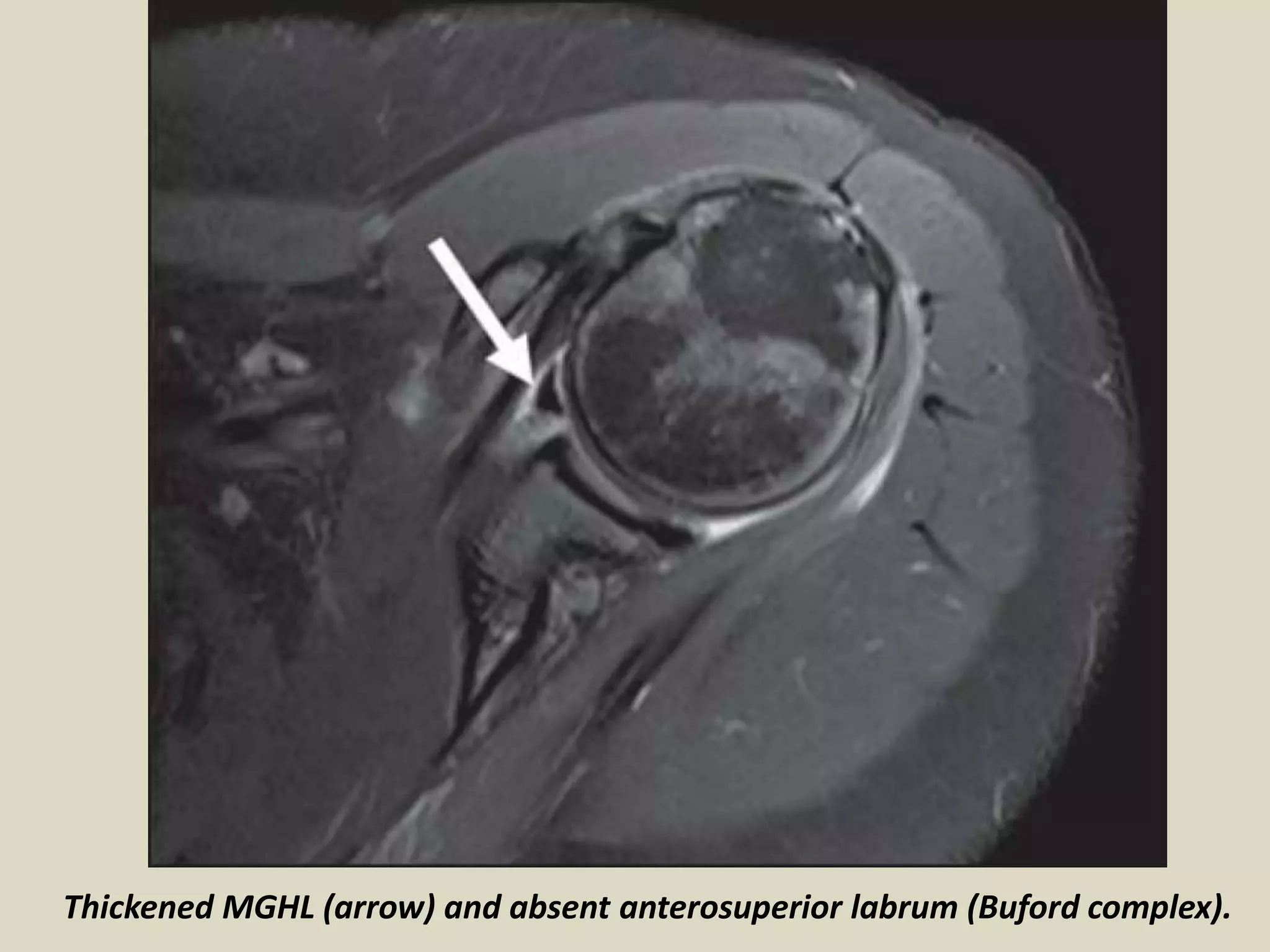 Presentation1, radiological imaging of artifact and pitfalls in ...