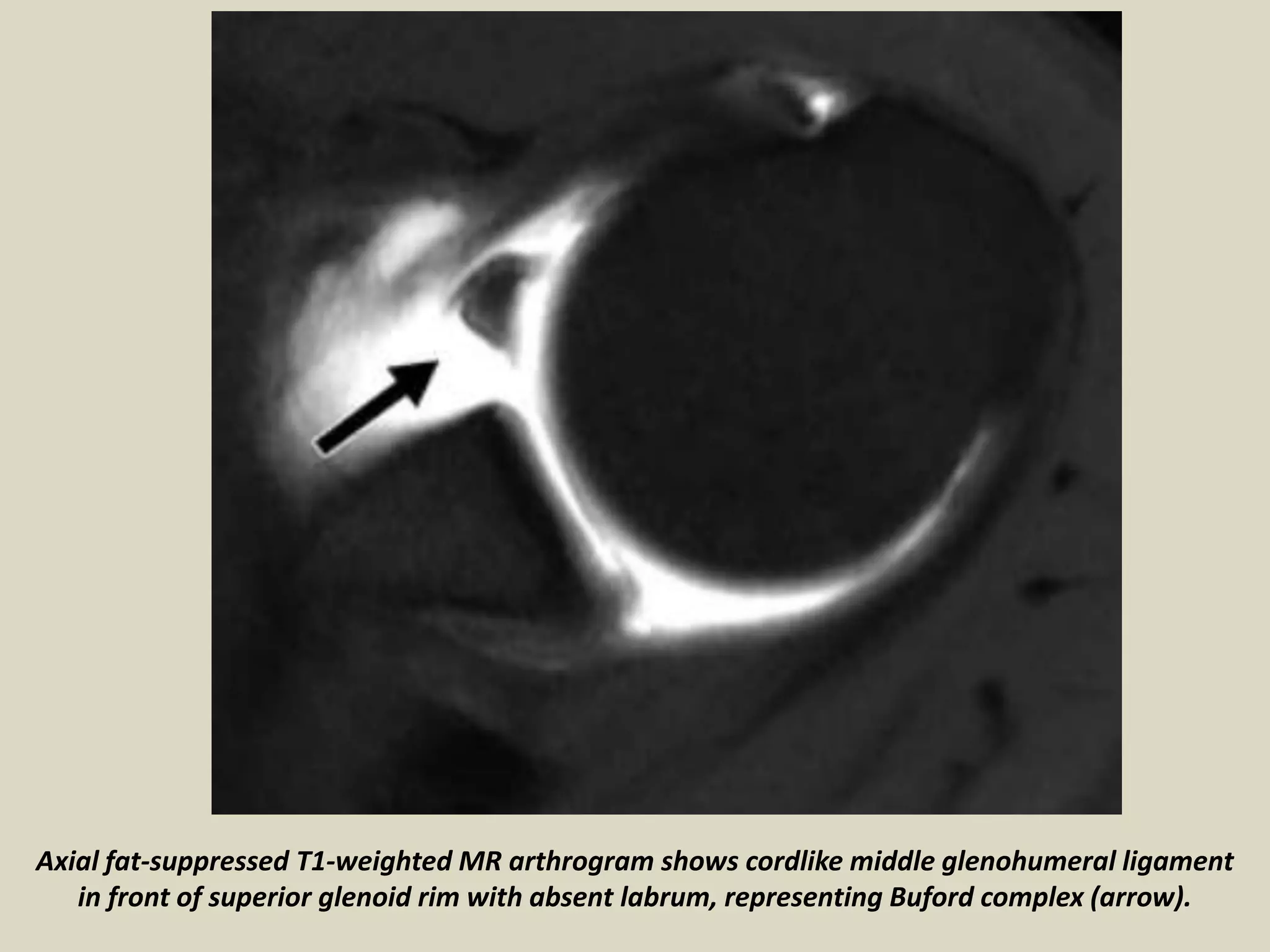 Presentation1, radiological imaging of artifact and pitfalls in ...