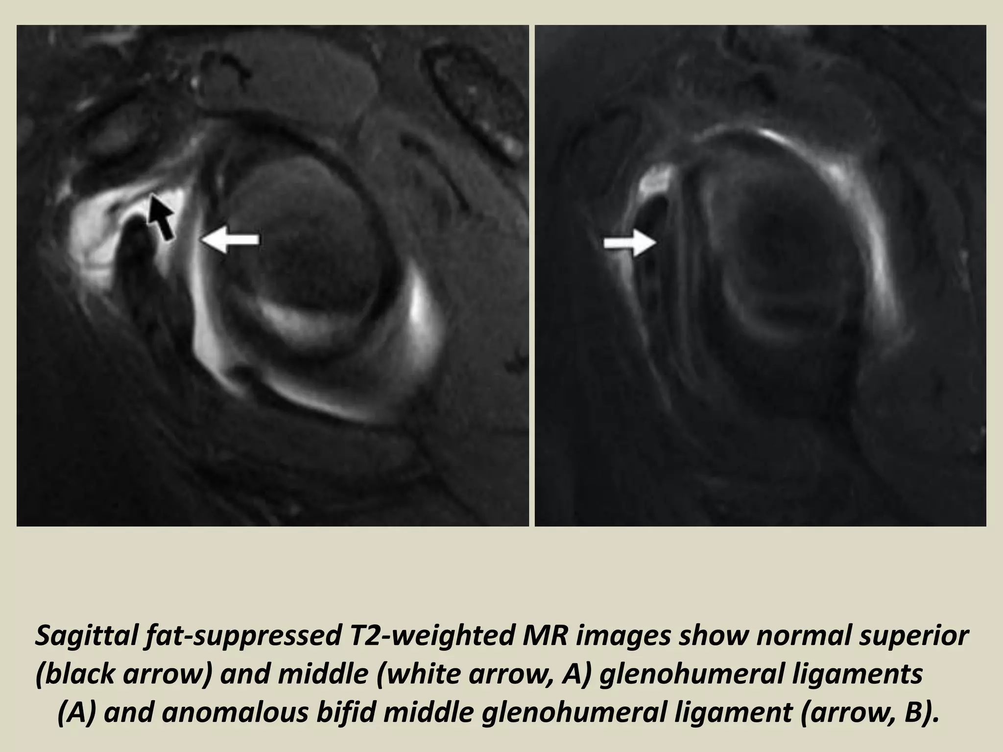 Presentation1, radiological imaging of artifact and pitfalls in ...