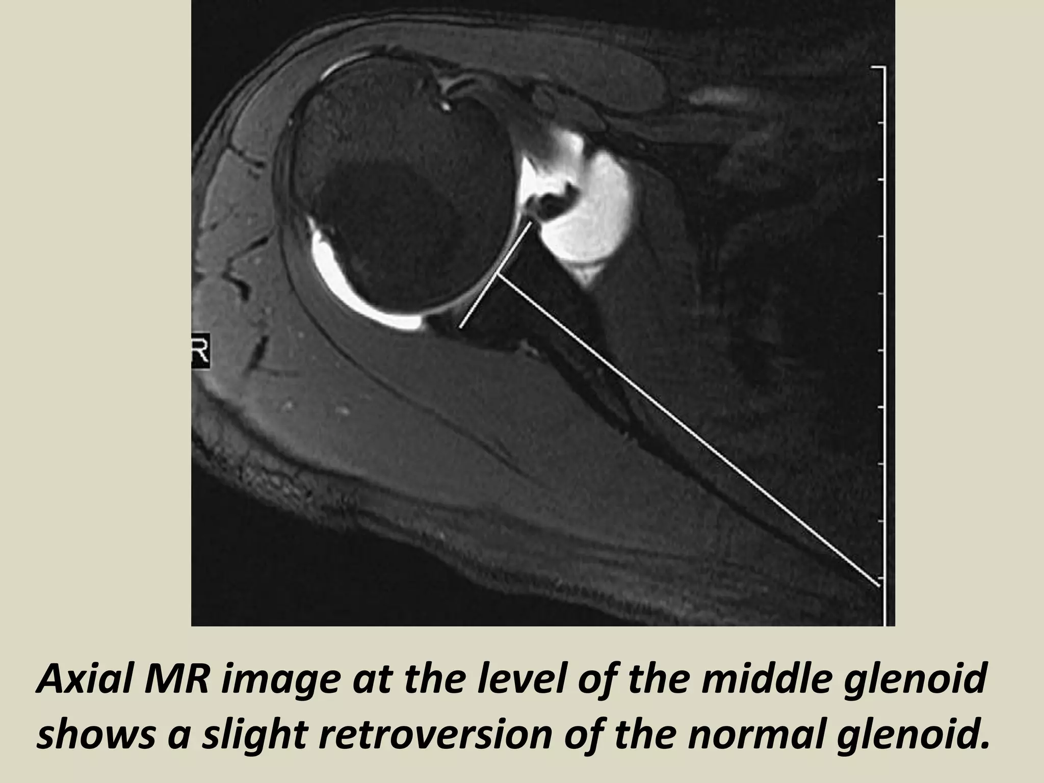 Presentation1, radiological imaging of artifact and pitfalls in ...